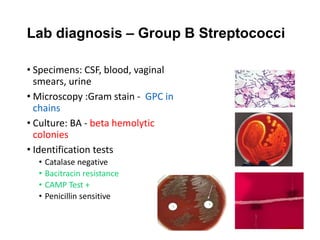 Streptococcus ldentification | PPTX | Ear, Nose and Throat Conditions ...