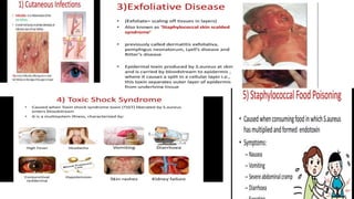 strepto vs staphylo present (2).pptx