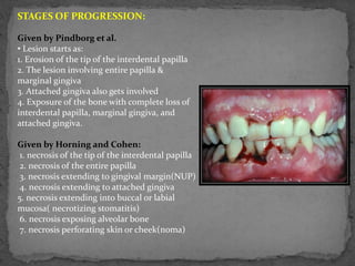 Stress and periodontium | PPTX