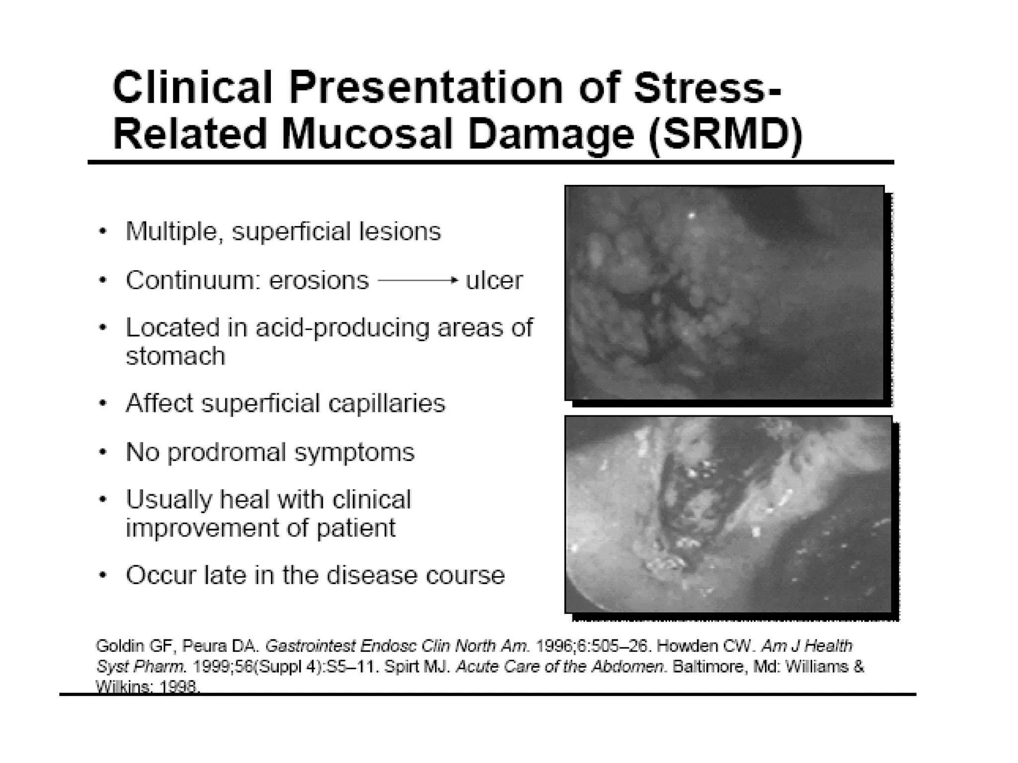 Stress Ulcer Prophylaxis In The Icu | PPT