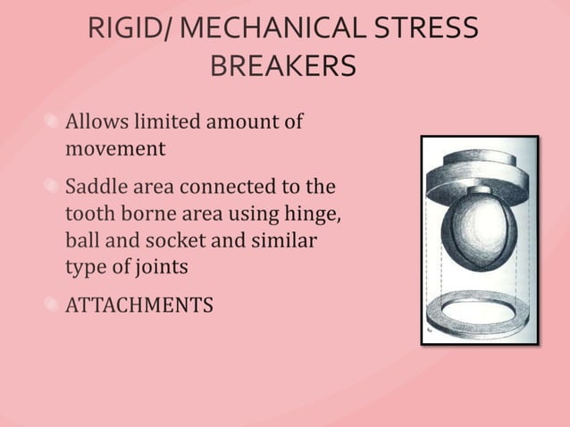 Stress breaker in rpd | PPT | Dental Health | Diseases and Conditions