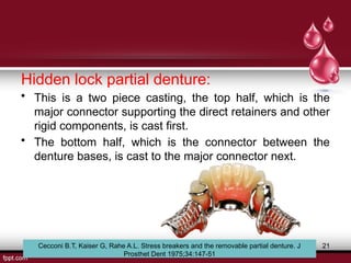 STRESS BREAKERS IN PROSTHODONTIC DENTISTRY | PPTX
