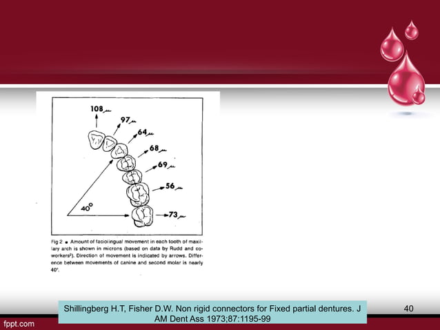 STRESS BREAKERS IN PROSTHODONTIC DENTISTRY | PPTX