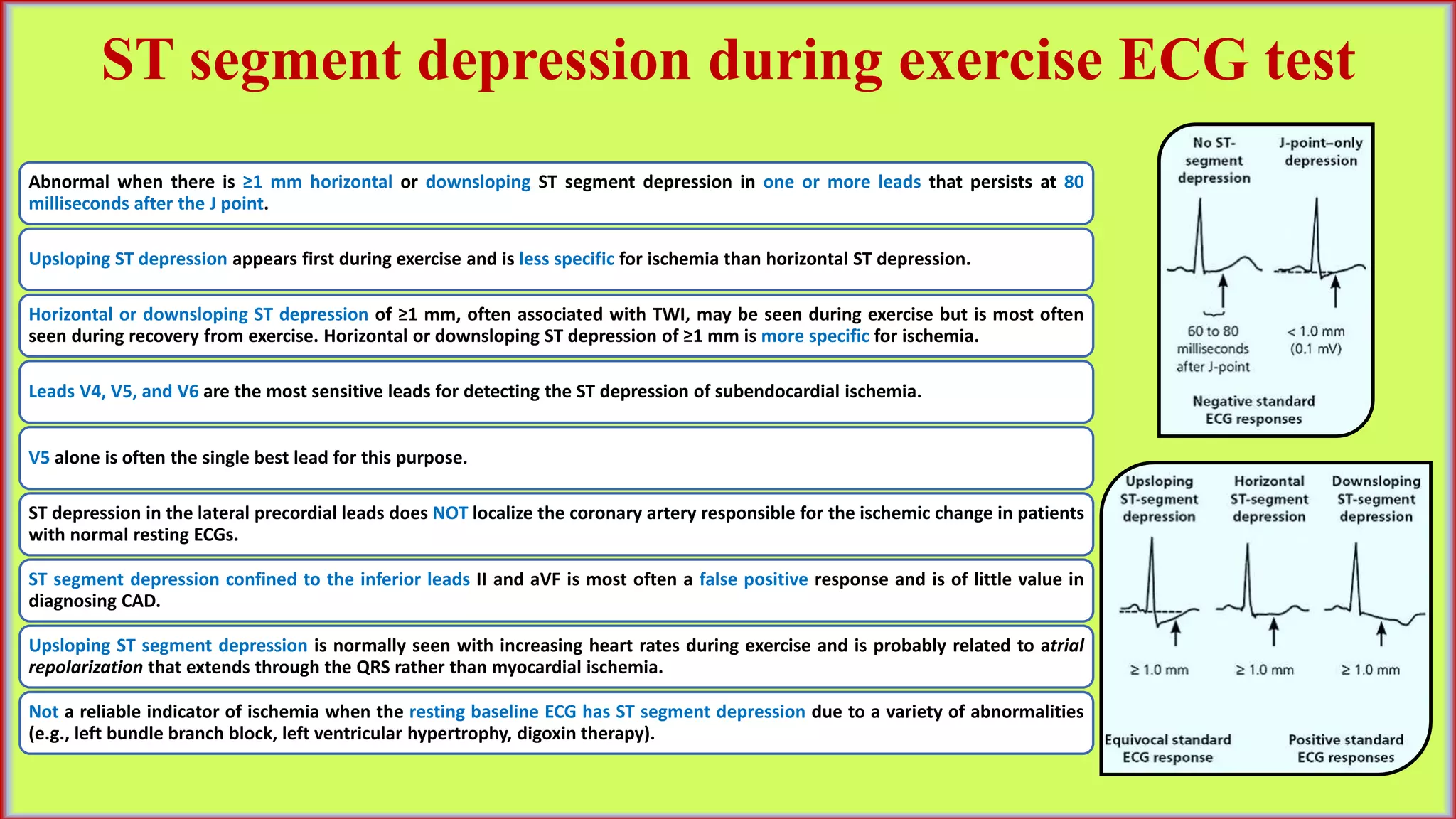 Exercise ECG Testing | PPTX