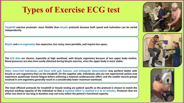 Exercise ECG Testing | PPTX | Heart and Cardiovascular Diseases ...