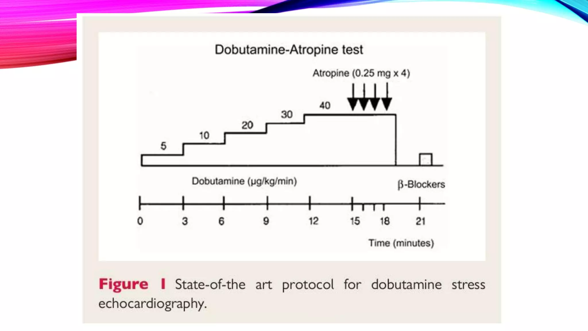 Stress echocardiography/Dobutamine stress echocardiography | PPTX