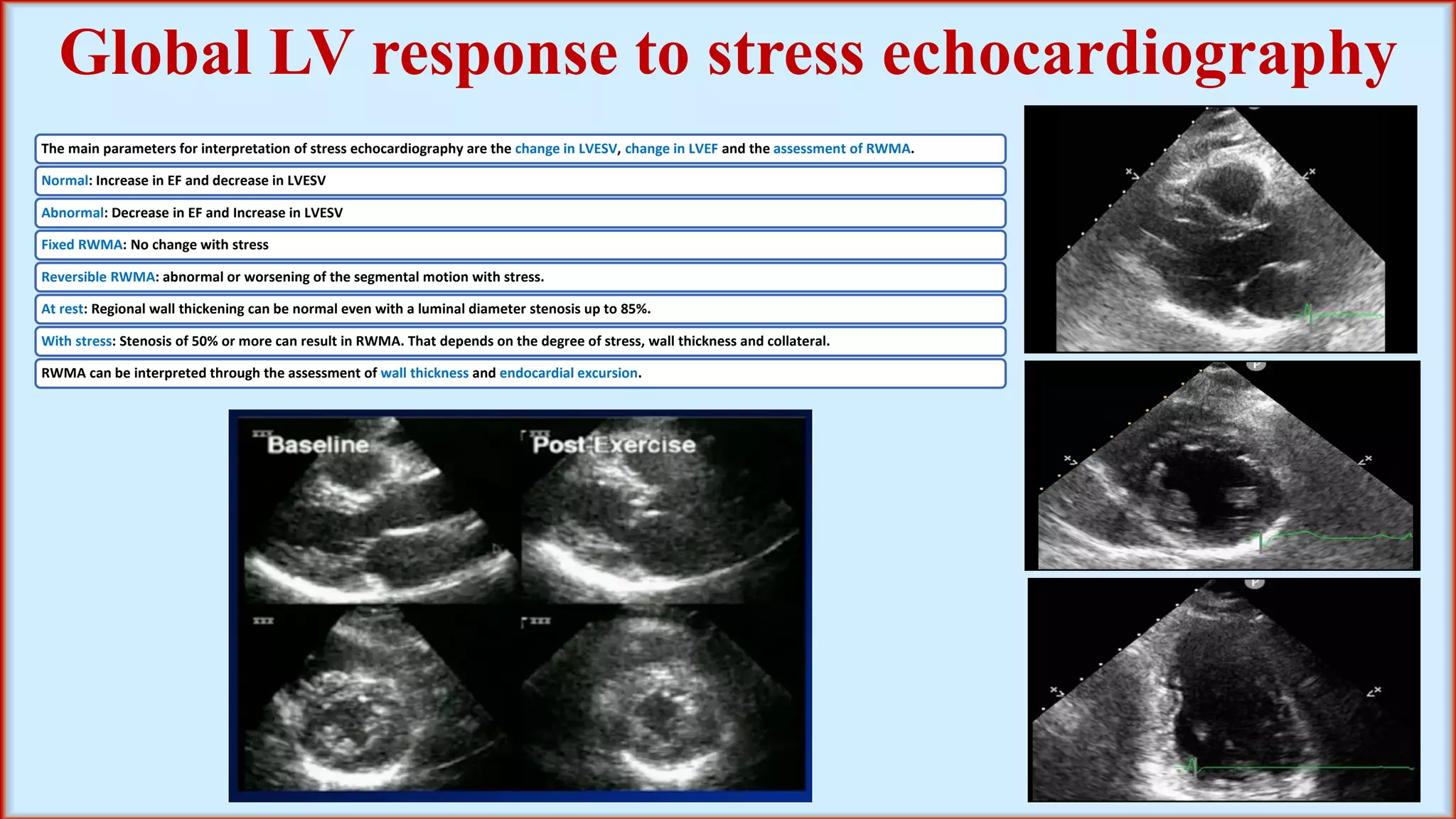 Stress Echocardiography | PDF