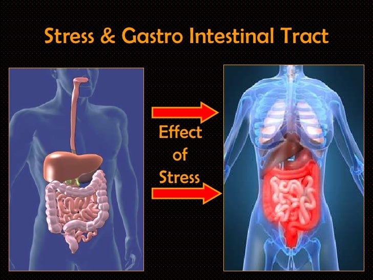 Stress & Gastrointestinal Problems