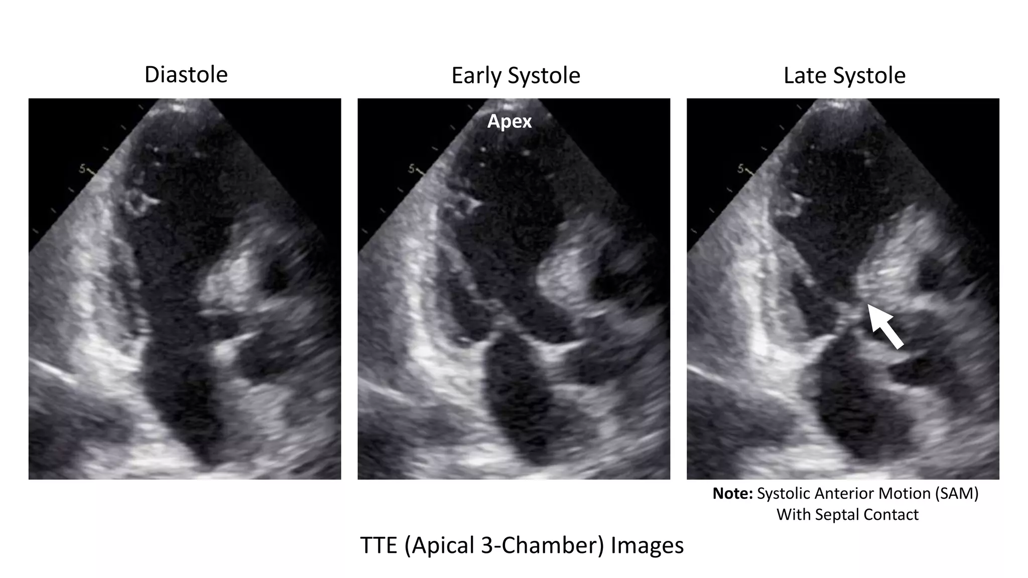 EMGuideWire's Radiology Reading Room: Stress-Induced Cardiomyopathy | PPTX