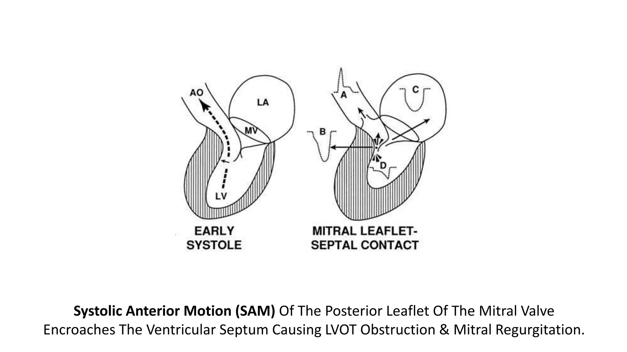 EMGuideWire's Radiology Reading Room: Stress-Induced Cardiomyopathy | PPTX