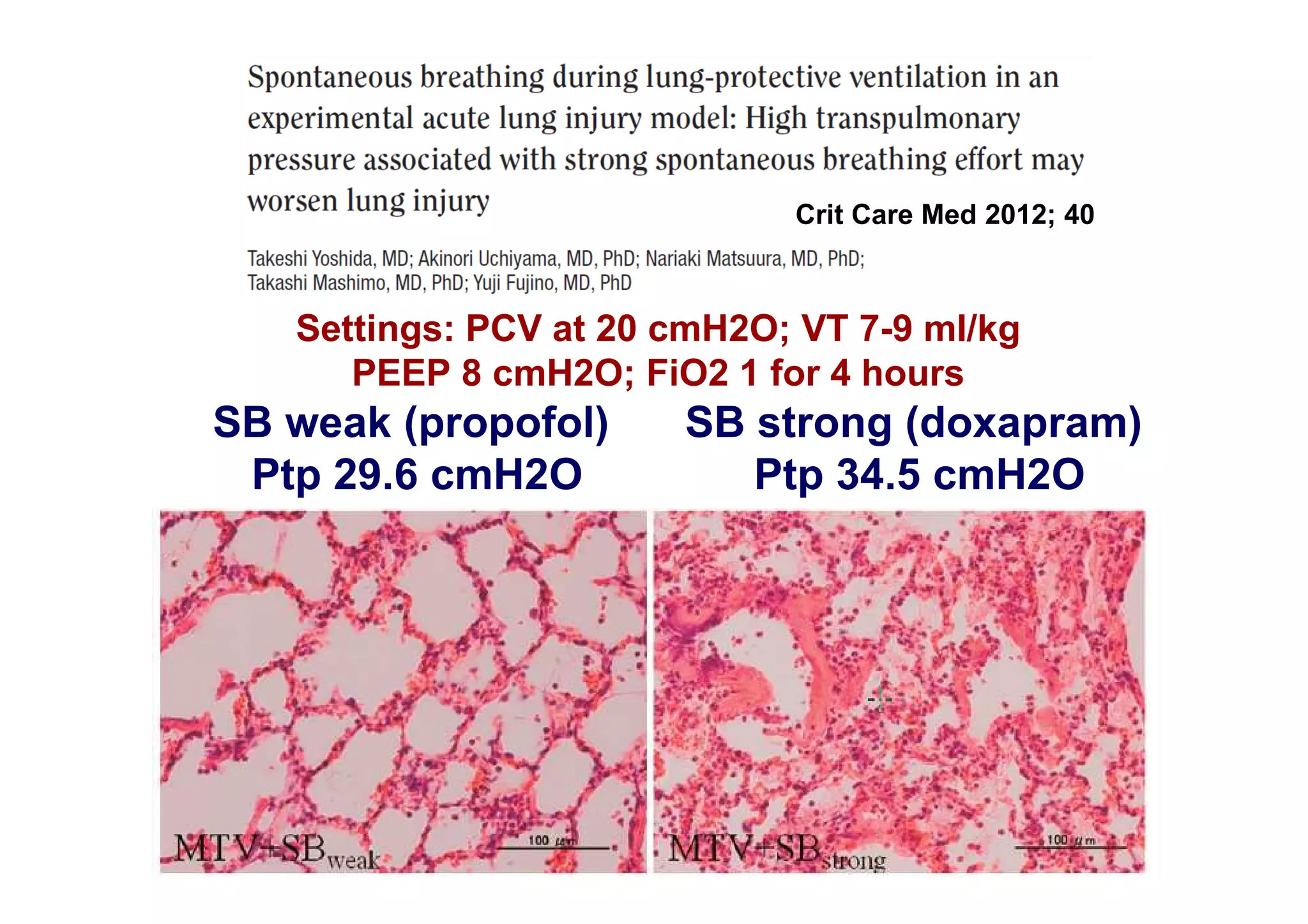 Stress & Strain during Lung Protective Ventilation Egypt Pulmonary ...