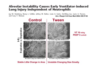Stress & Strain during Lung Protective Ventilation Egypt Pulmonary ...
