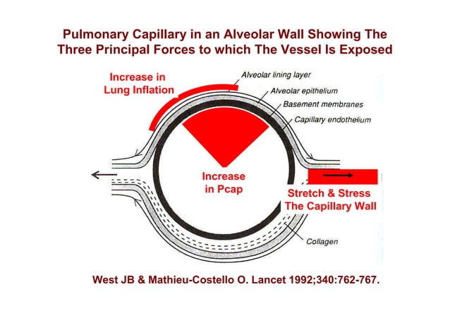 Stress & Strain during Lung Protective Ventilation Egypt Pulmonary ...