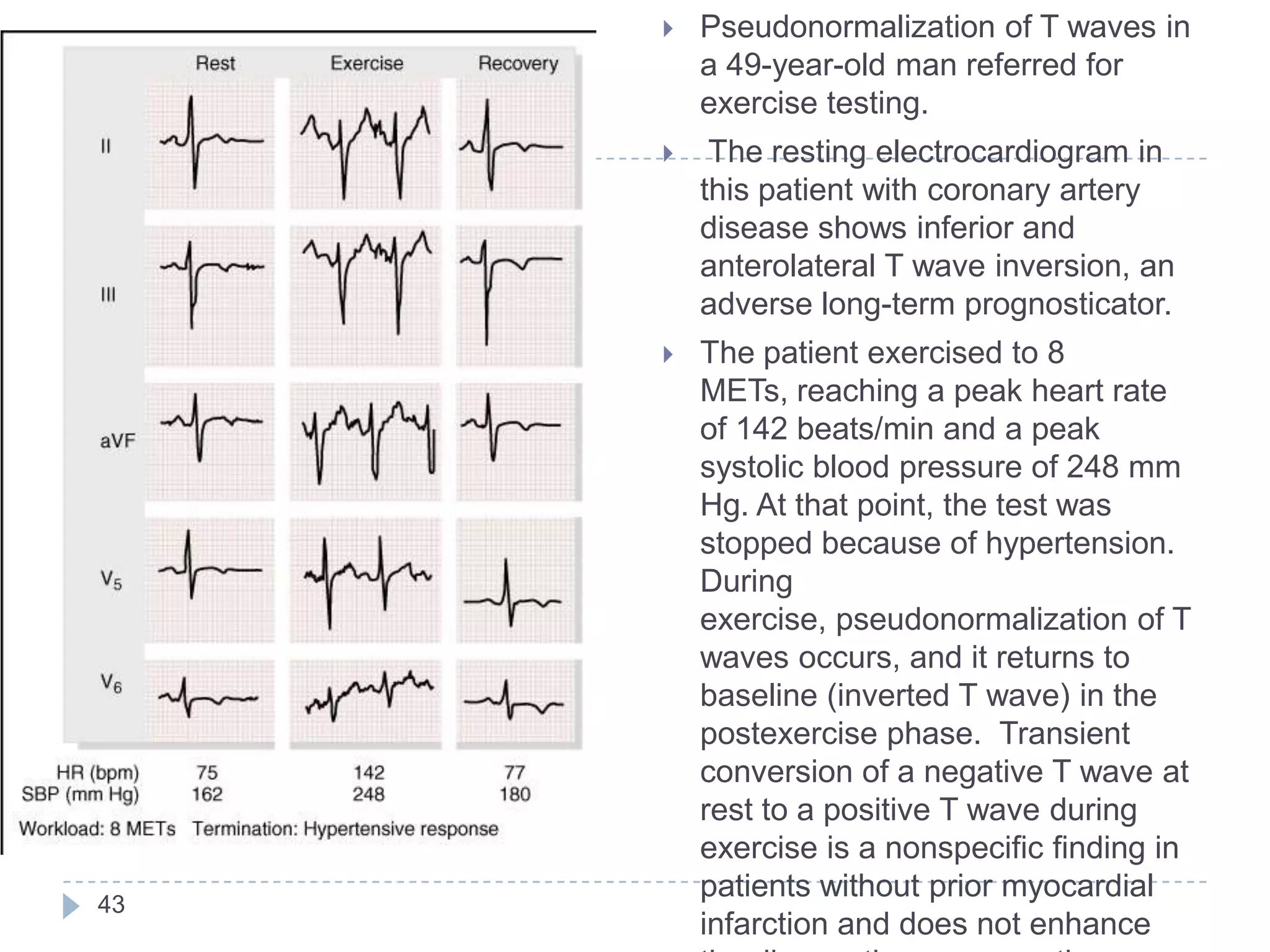 Stress Testing | PPTX