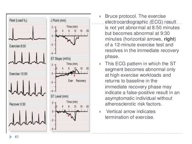 Treadmill Stress Test Abnormal Results