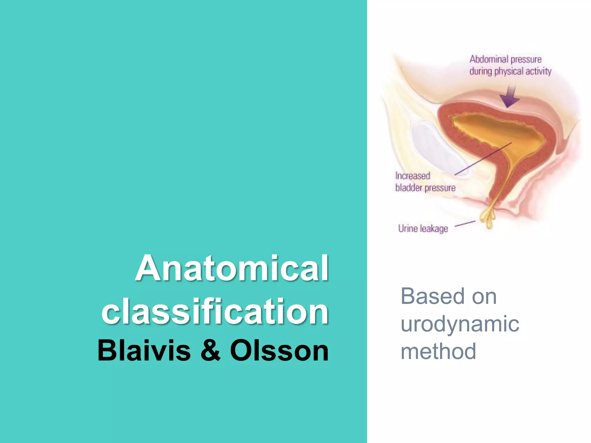 Stress Urinary Incontinence Ppt