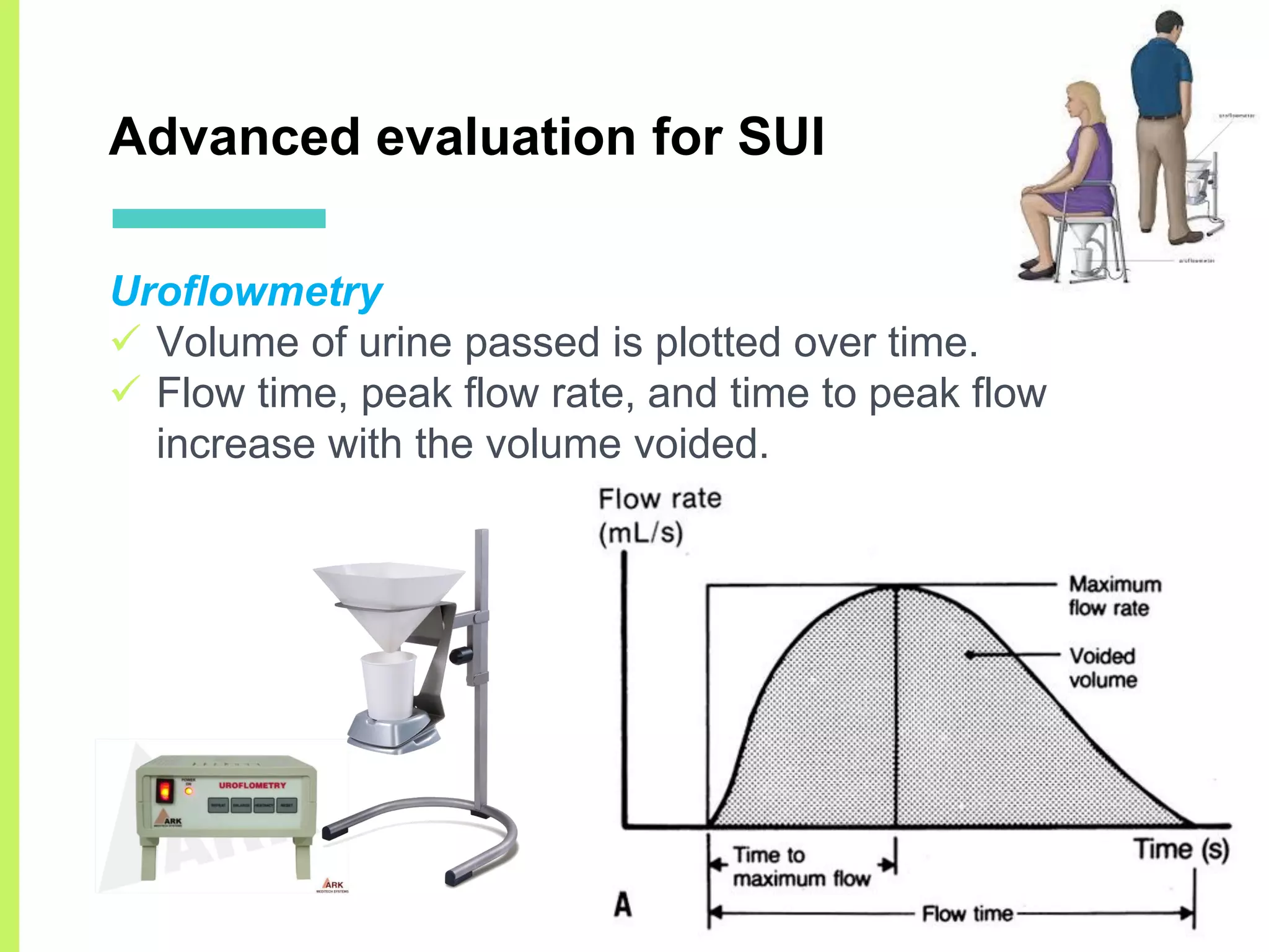 Stress urinary incontinence | PDF