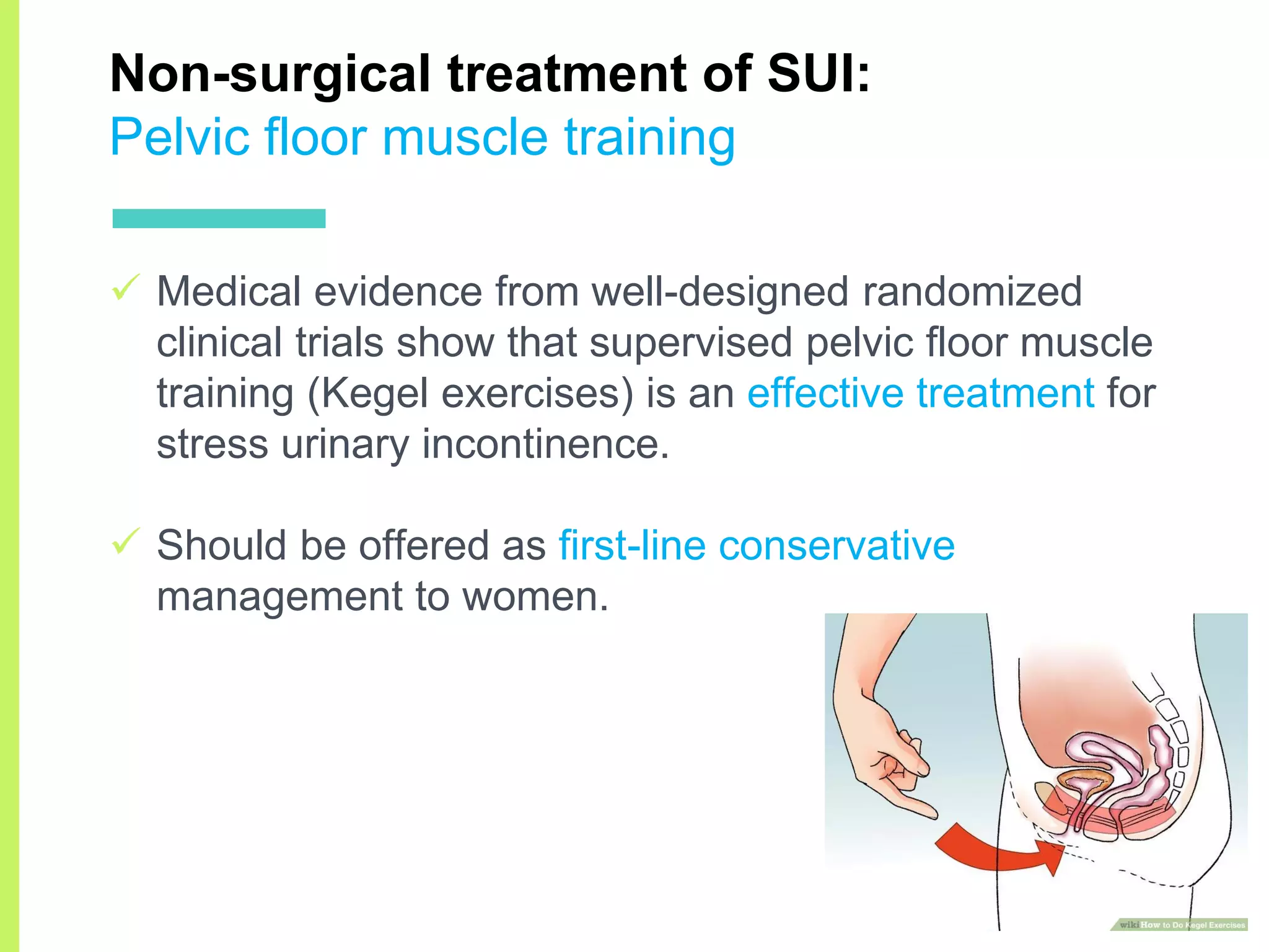 Stress urinary incontinence | PDF