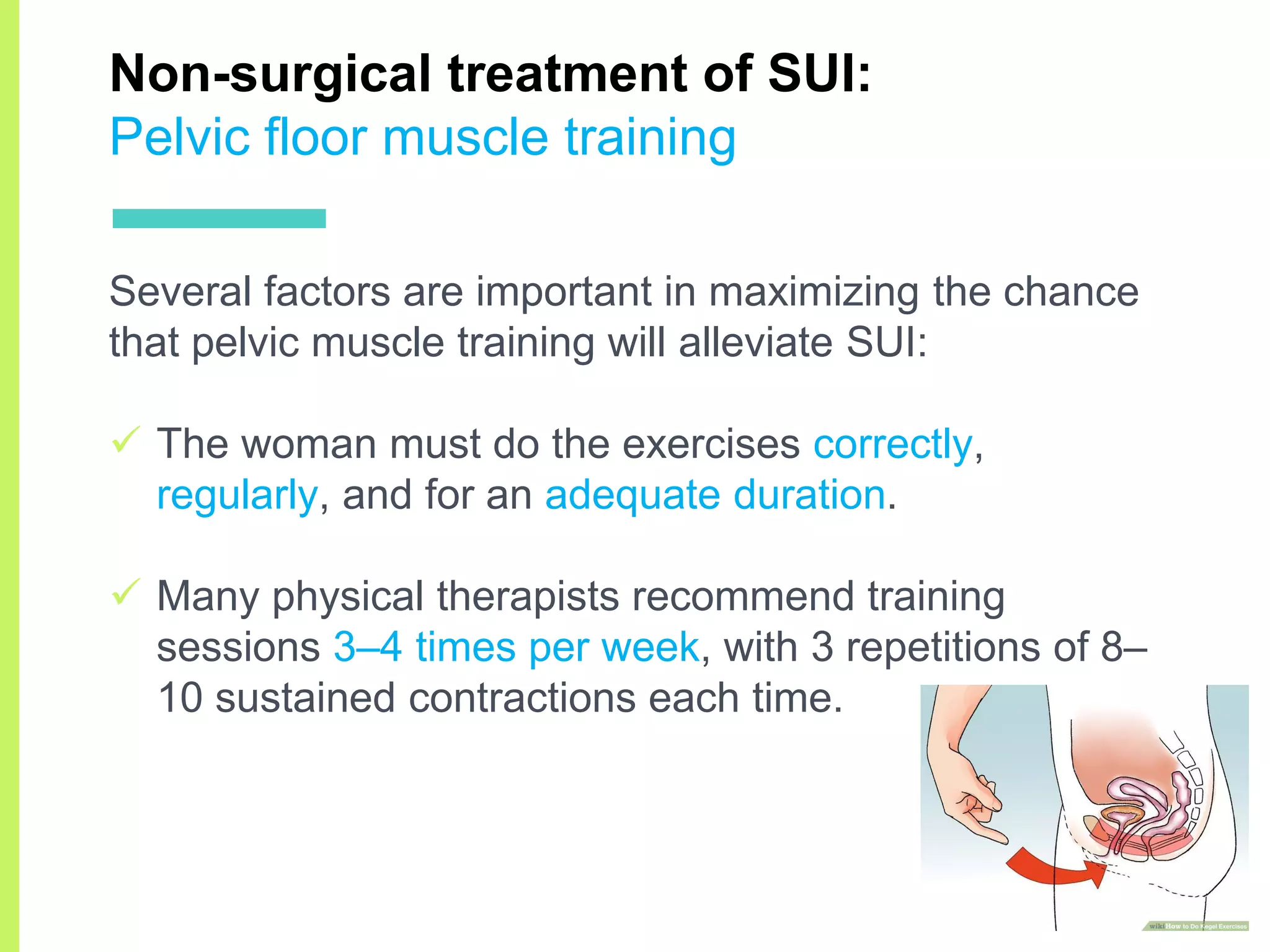 Stress urinary incontinence | PDF