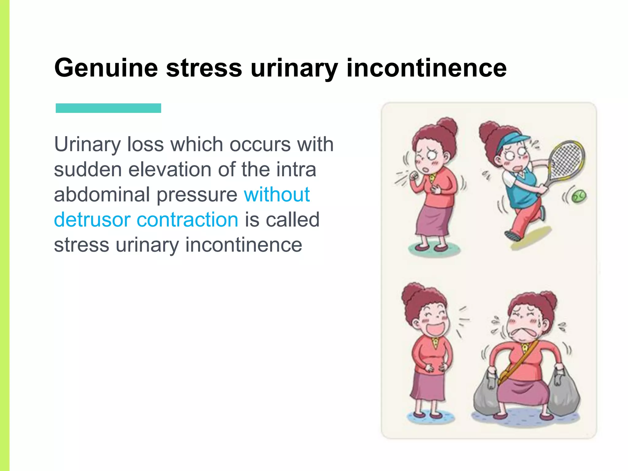 Stress urinary incontinence | PDF