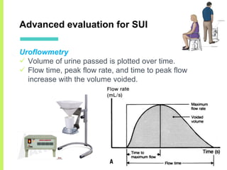 Stress urinary incontinence | PDF
