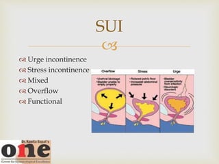 Stress urinary incontinence dr. kawita bapat | PPTX