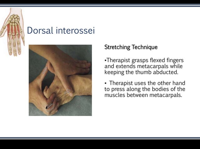 STRETCHING-UPPER LIMB.pptx