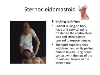 Sternocleidomastoid Stretches