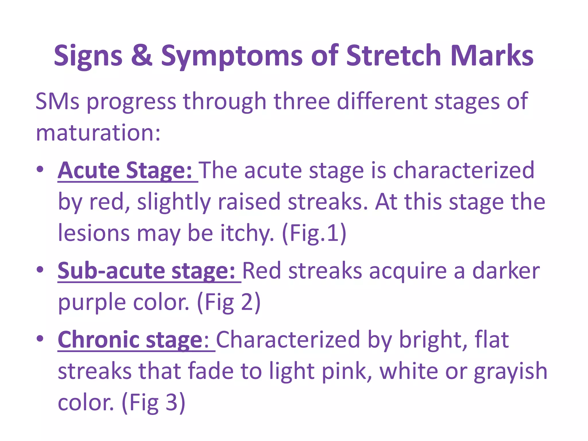 How to Deal with Stretch Marks | PPTX