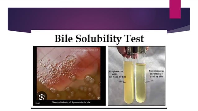 Streptococcus Pneumoniae Streptococcus Slideshare Ppt