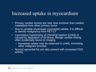 Non-malignant cardiac findings on FDG PET CT | PPTX