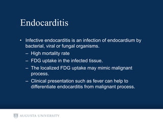 Non-malignant cardiac findings on FDG PET CT | PPTX