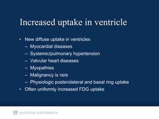 Non-malignant cardiac findings on FDG PET CT | PPT