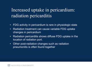Non-malignant cardiac findings on FDG PET CT | PPTX