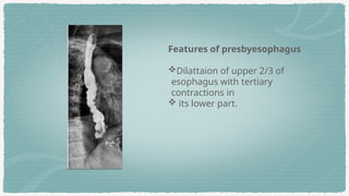 Radiographic imaging of esophageal strictures.pptx