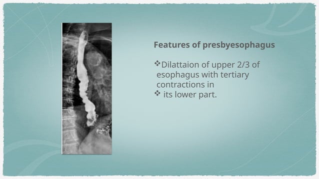 Radiographic imaging of esophageal strictures.pptx