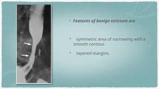 Radiographic imaging of esophageal strictures.pptx