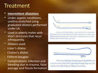 Stricture Urethra | PPTX | Death, Injury, or Military Conflict ...