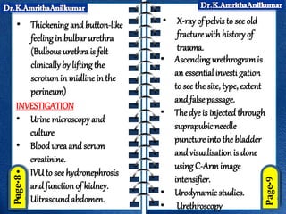 Stricture urethra by Dr.K.AmrithaAnilkumar | PPT