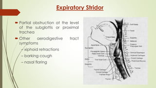 Stridor In Children | PPTX