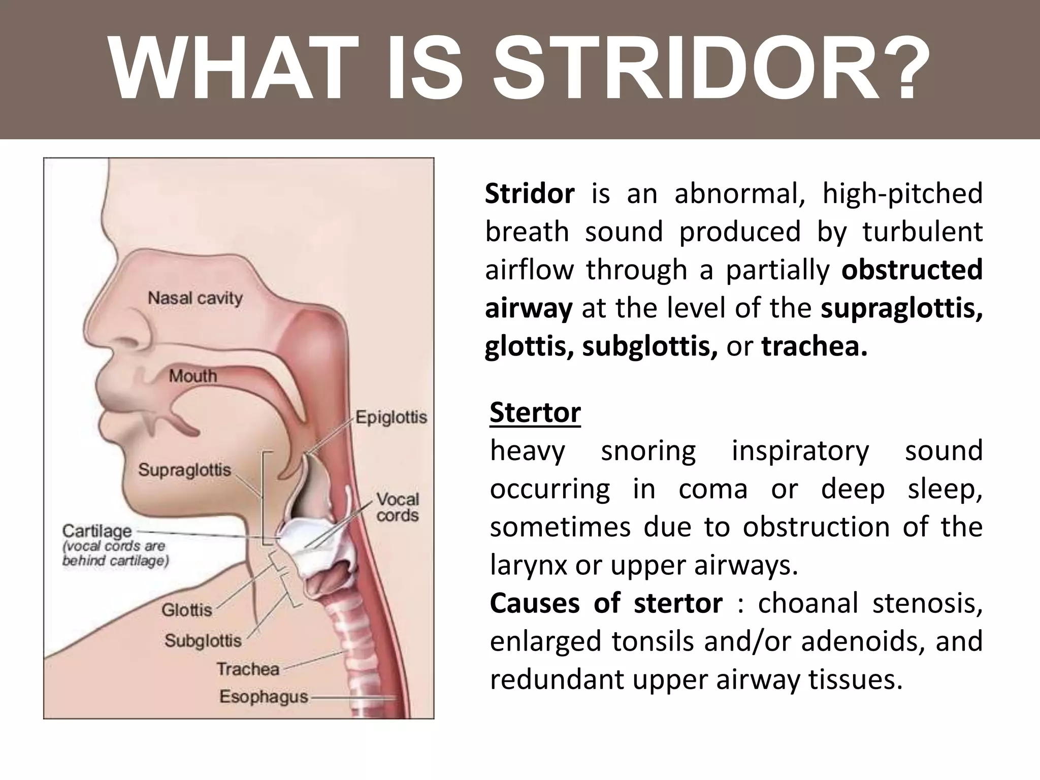 Stridor | PPTX