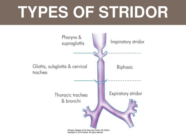 Stridor