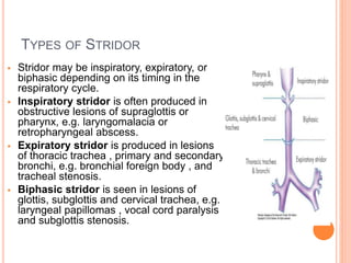 Stridor | PPTX