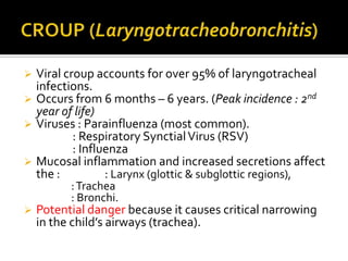 Stridor by Dr. Anna | PPTX