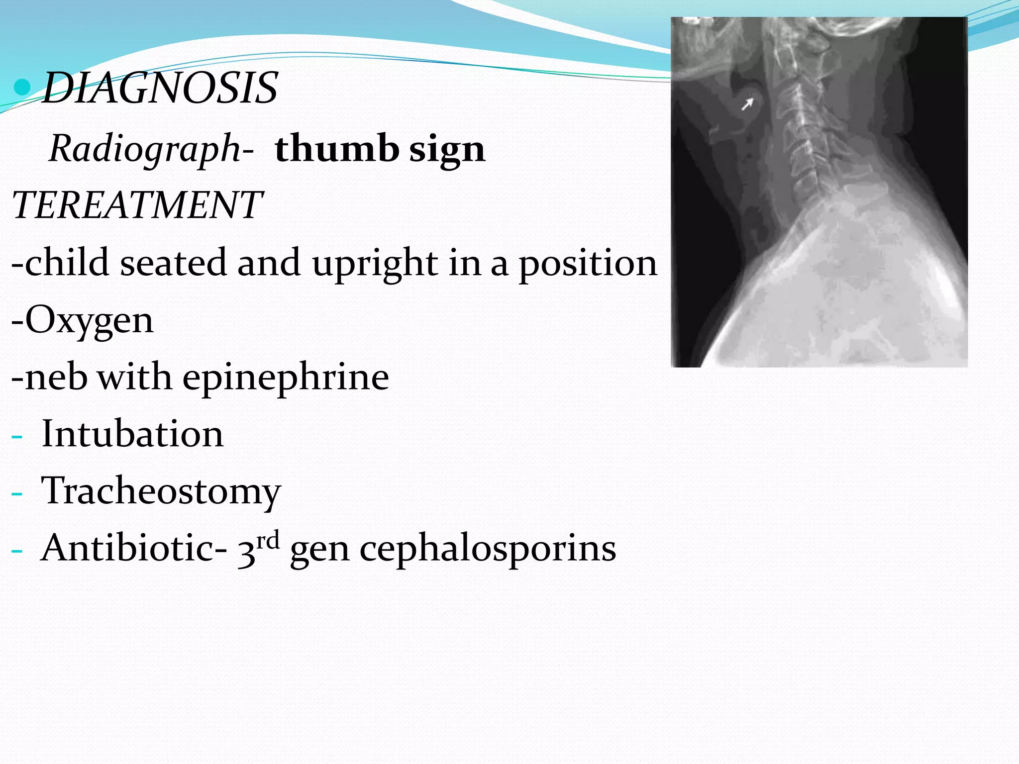 Stridor and drooling in infants and children | PPTX