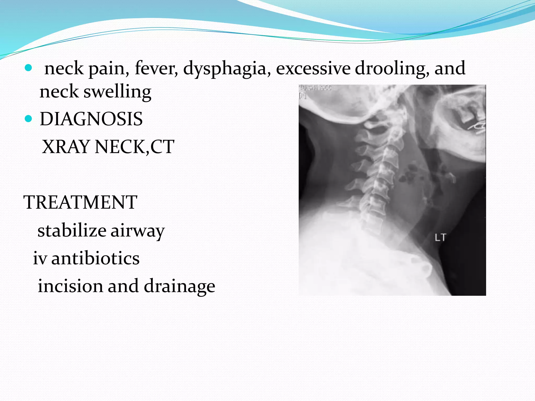 Stridor and drooling in infants and children | PPTX