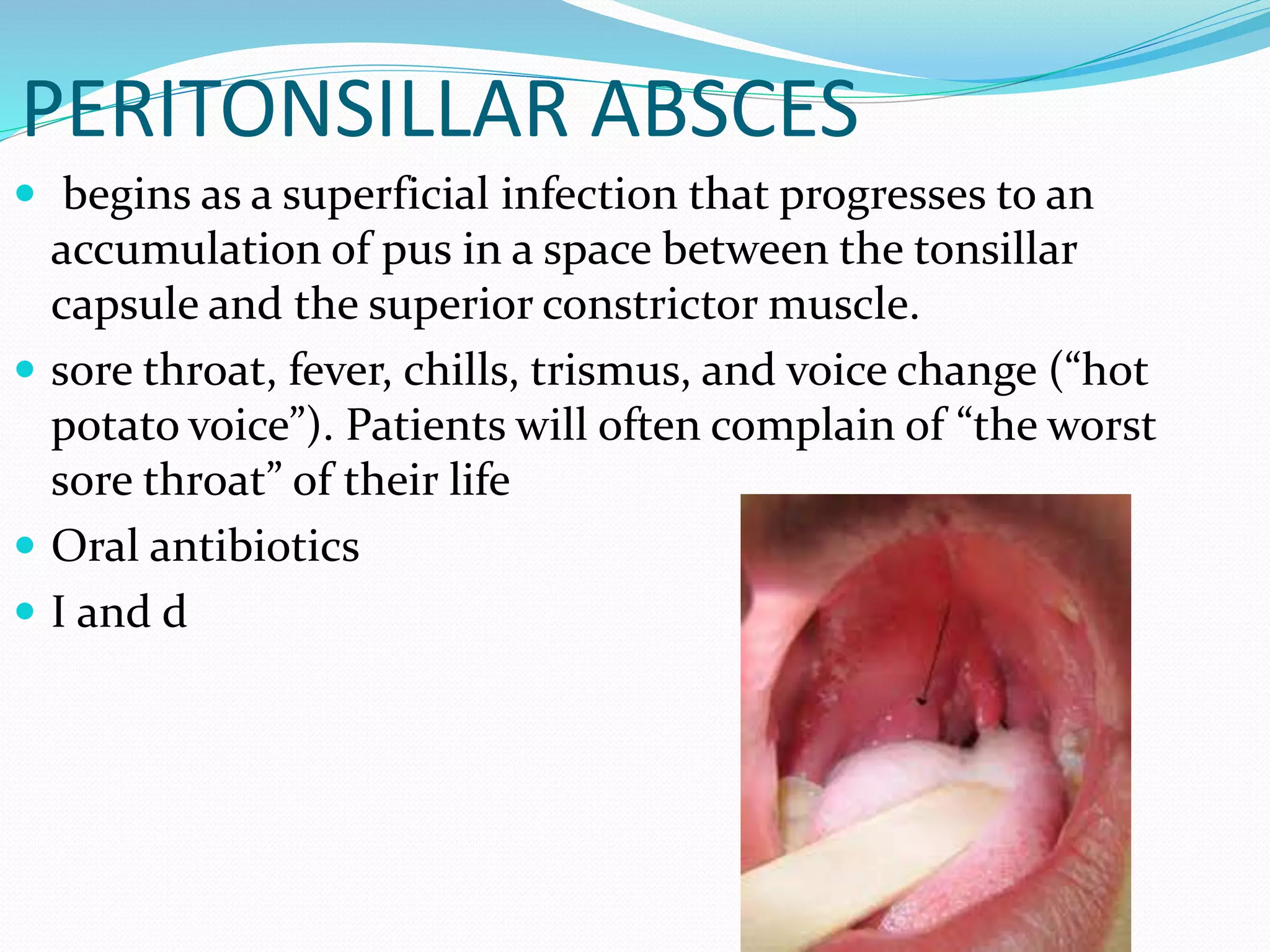 Stridor and drooling in infants and children | PPTX