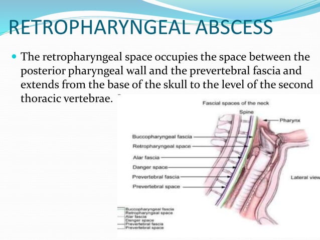 Stridor and drooling in infants and children | PPTX | Lung and ...