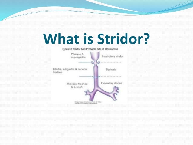 Stridor In Vocal Cord Palsy