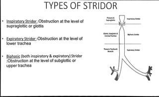 Approach to Stridor in Children - Pediatrics | PDF